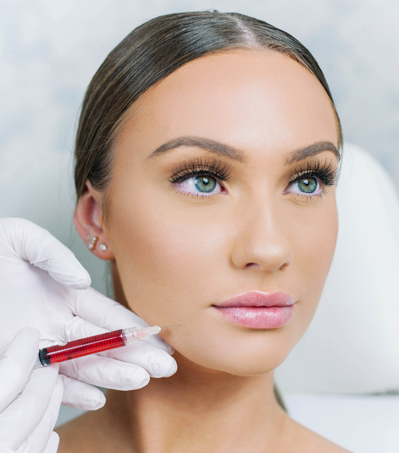 Vampire Facial - EUROPHORIA Medical and Personal Spa in Bakersfield ...