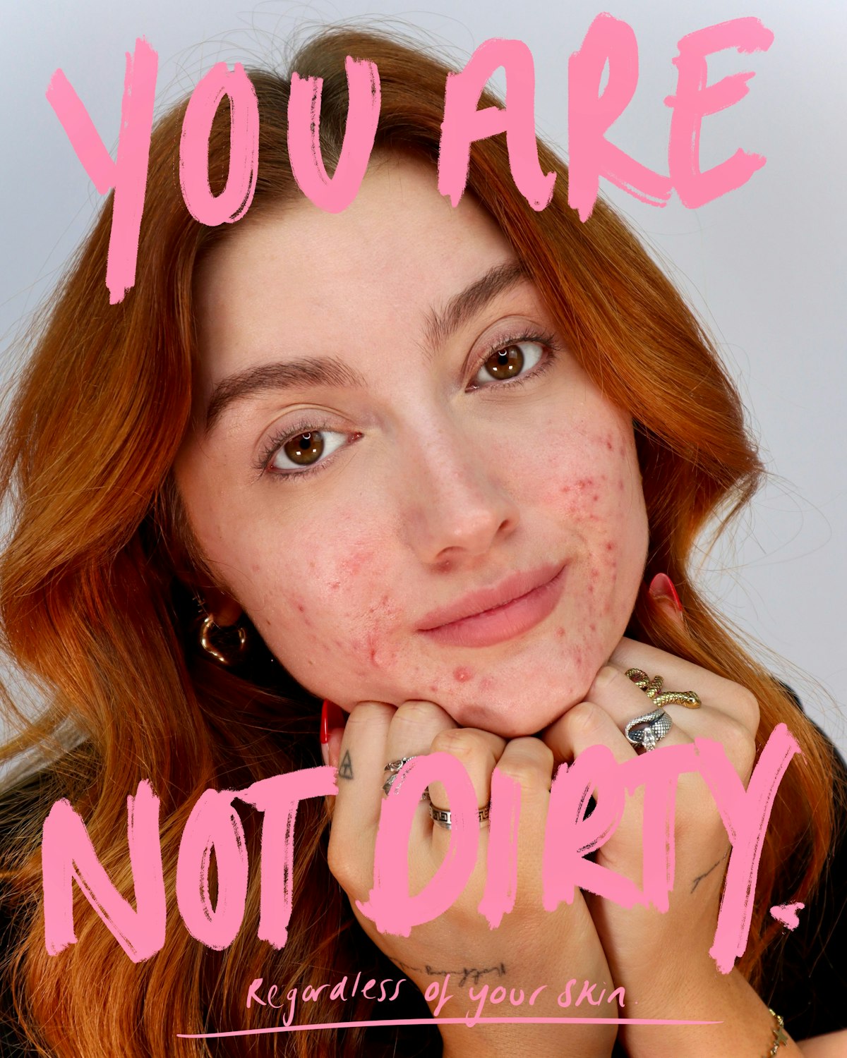 #NoFilter: Izzie Rodgers on Her Journey to Self-Love