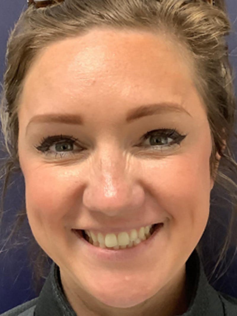 Patient 148394420 | Jennifer Thurman-Olivieri, APRN Before & After ...