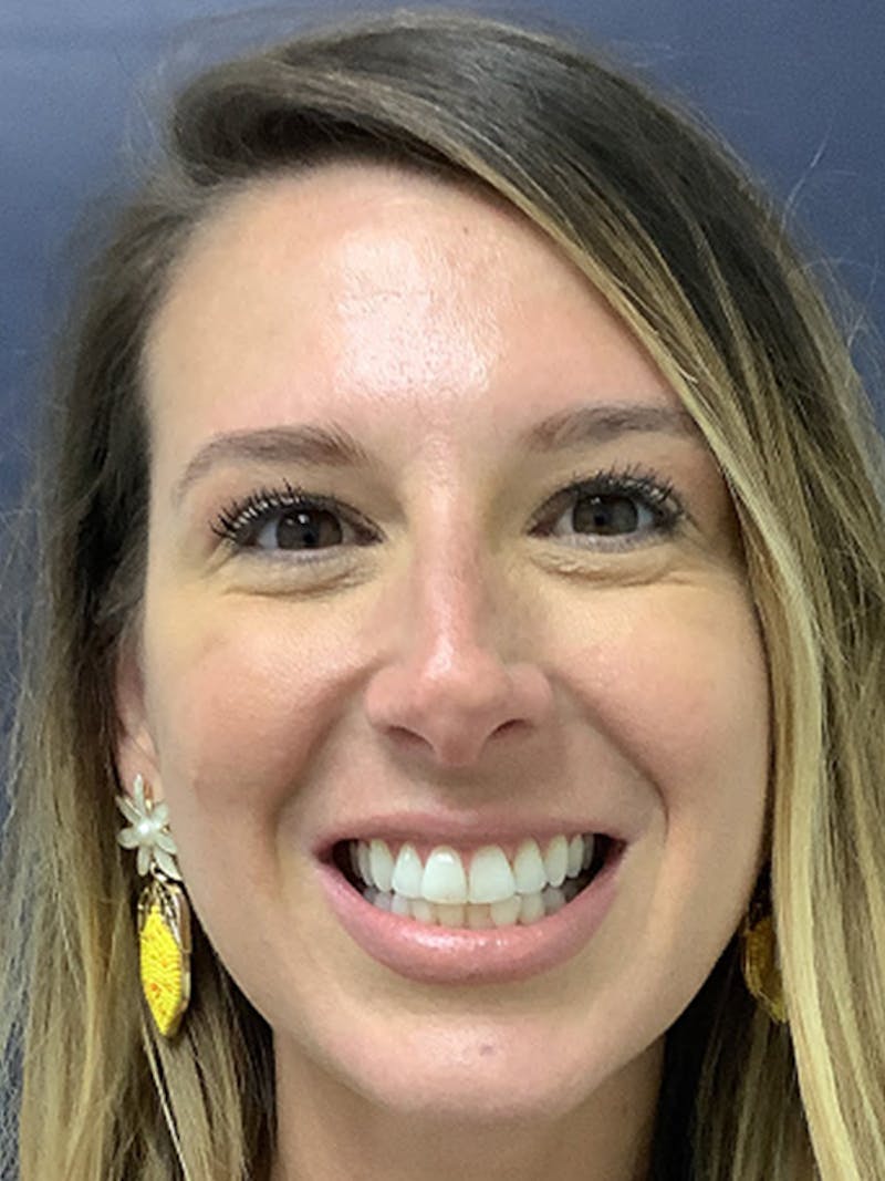 Patient 148394422 | Jennifer Thurman-Olivieri, APRN Before & After ...