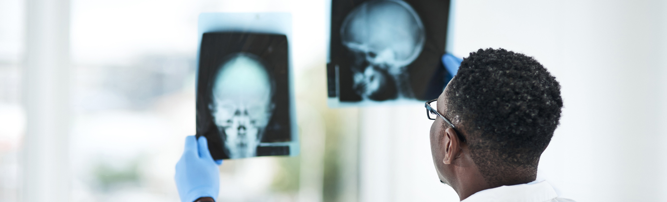 Auditory Brainstem Response | SFENTA