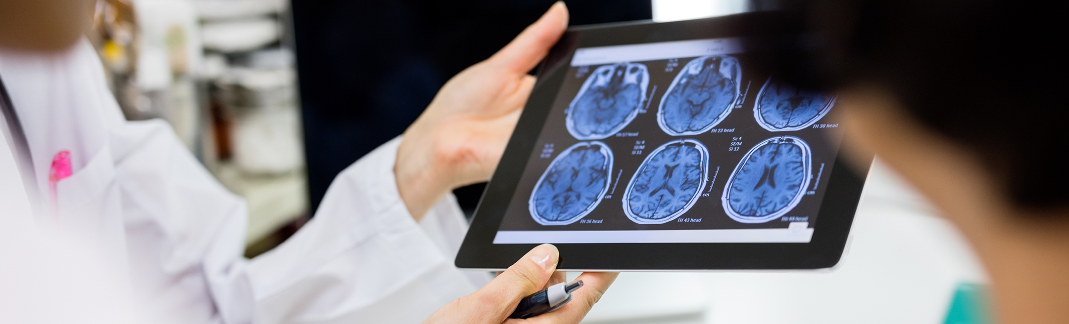 Temporal Bone Scans | SFENTA