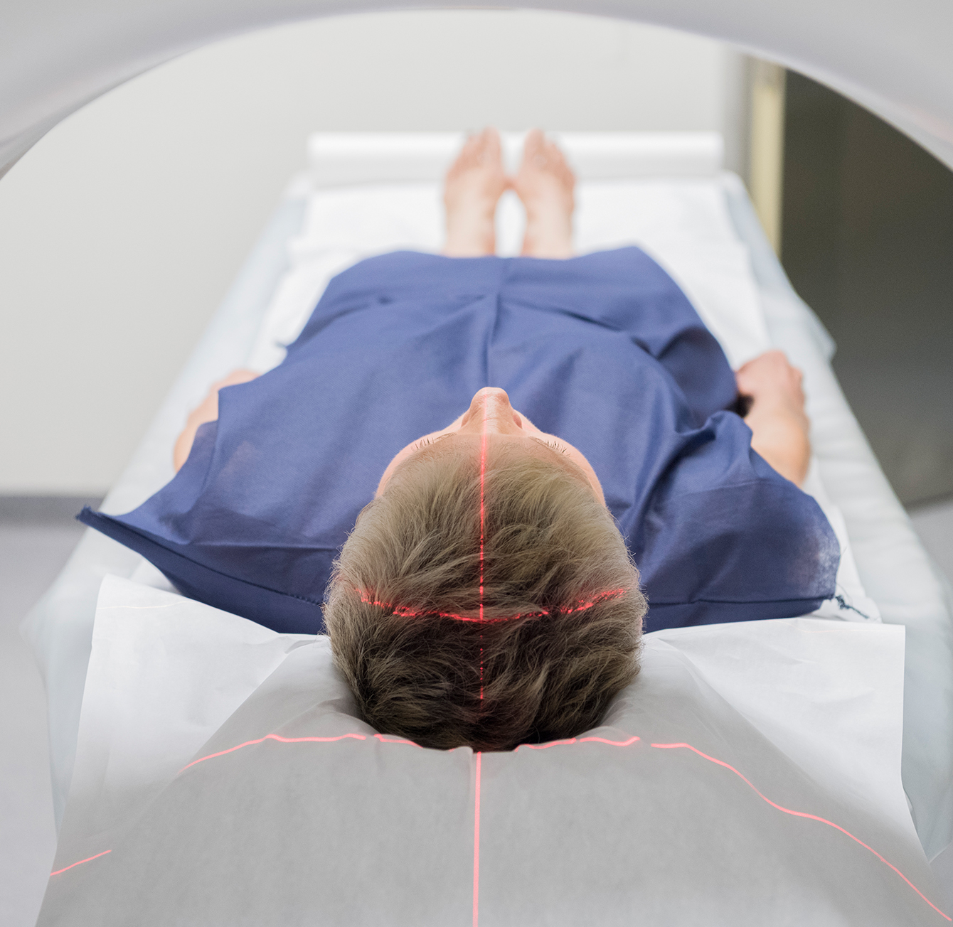 Temporal Bone Scans | SFENTA