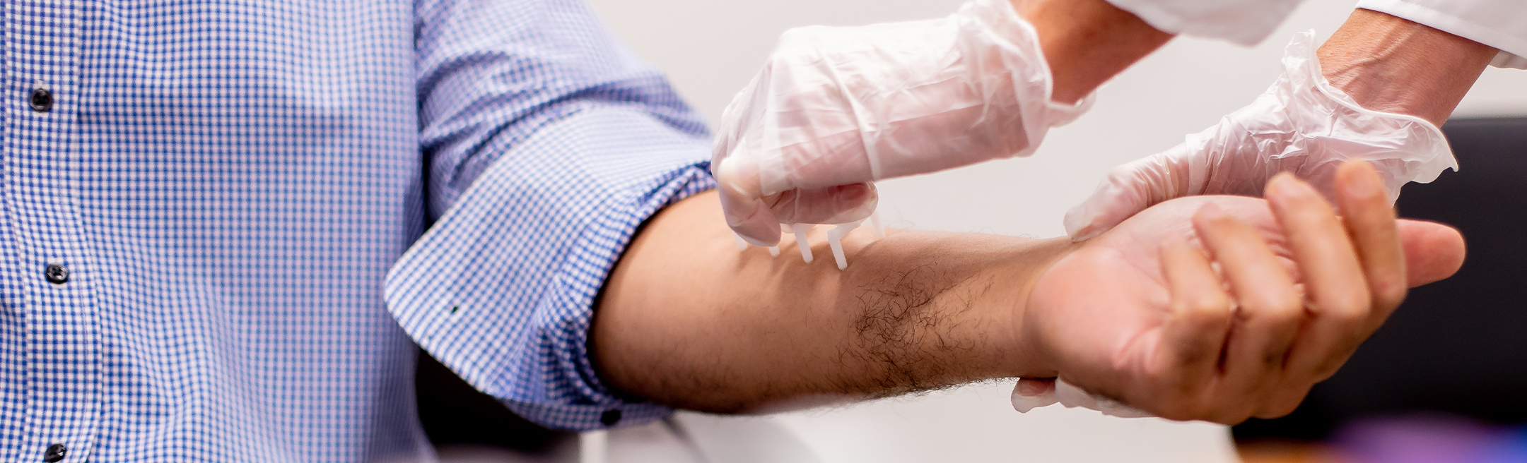 Food Allergy Testing Miami | SFENTA