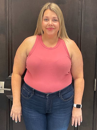 Semaglutide Before And After Photos Highwater Aesthetics