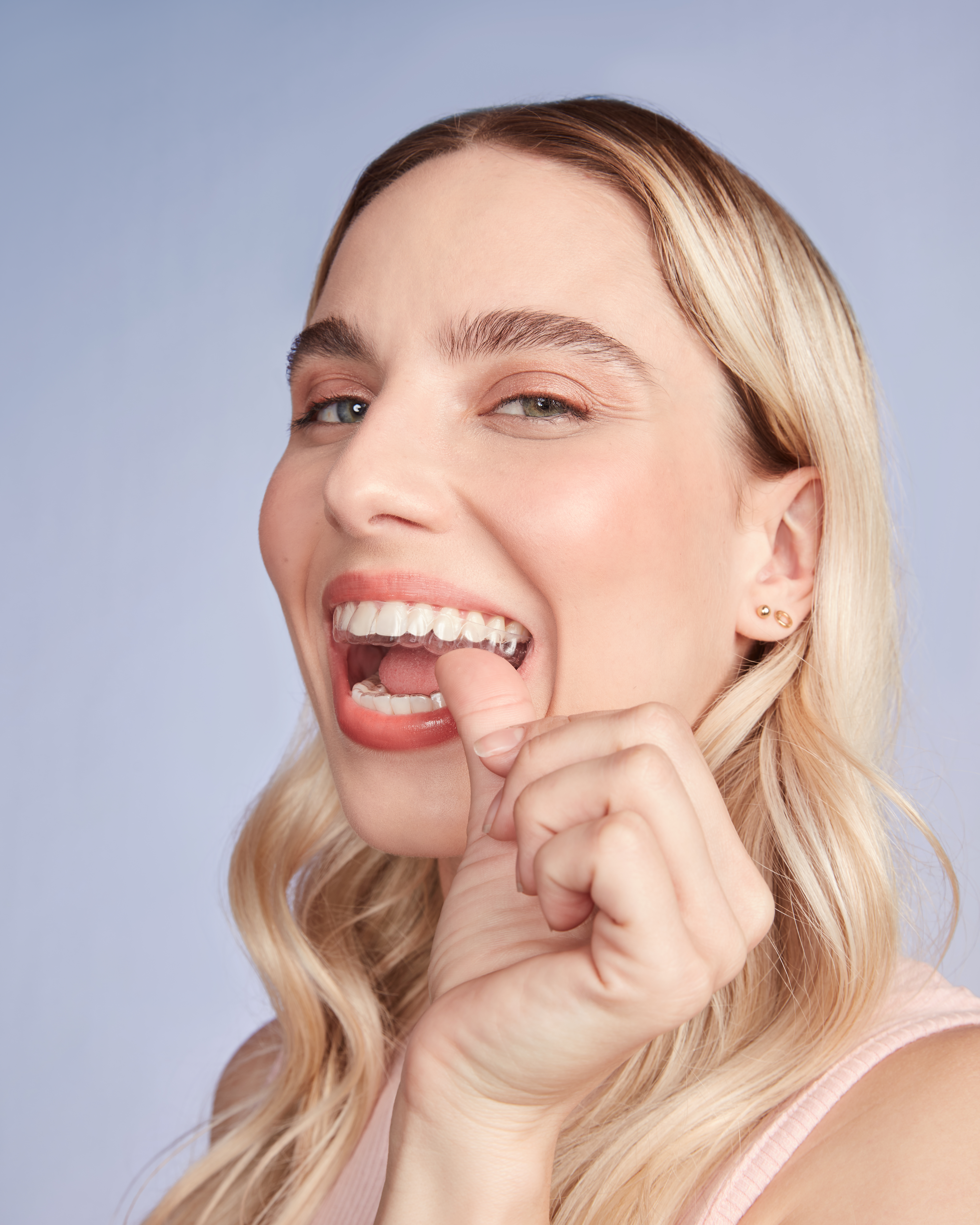 SouSmile ou Invisalign: quais as diferenças entre as marcas? - SouSmile