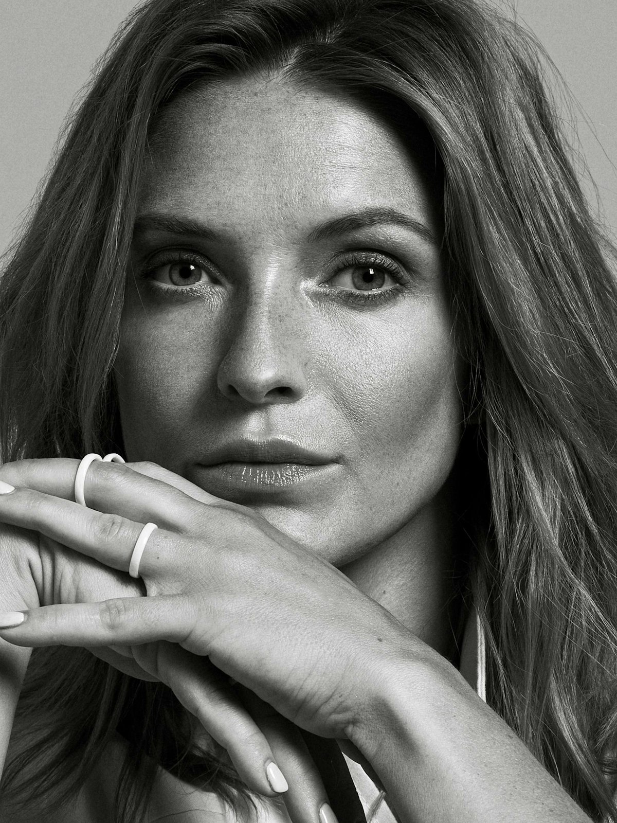 How to do Botox the European Way