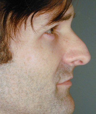 Perfect Male Nose Side View