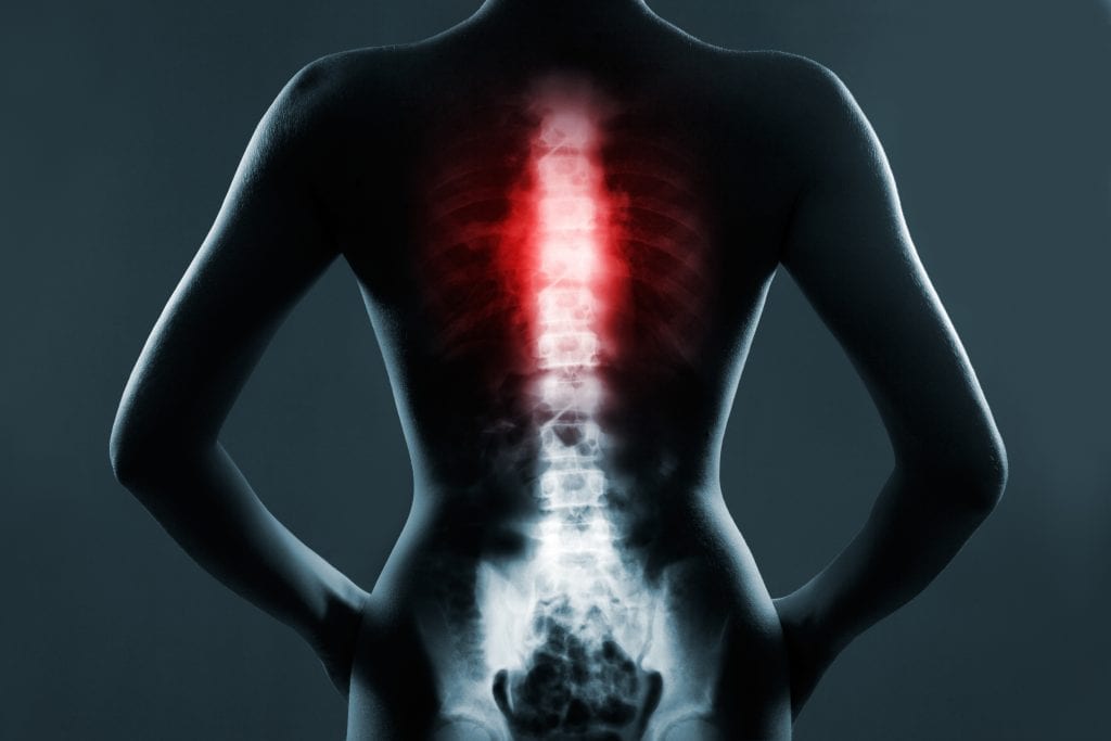 Spinal Trauma: Beyond Spinal Cord Injury