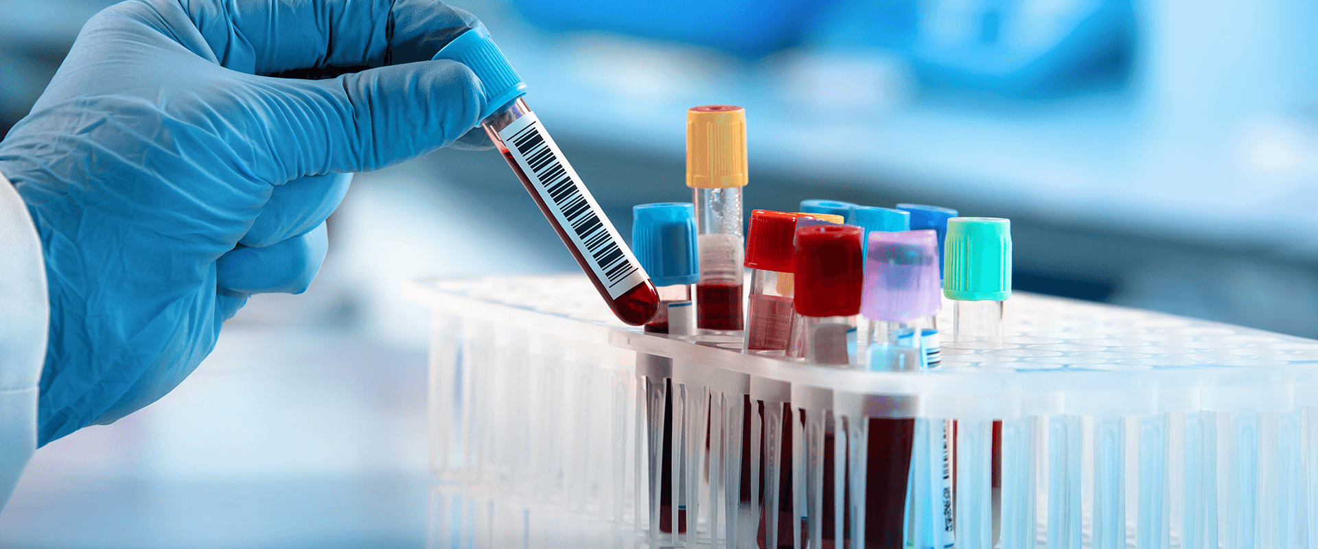 Bloedonderzoek | HealthCheckCenterHealthCheckCenter