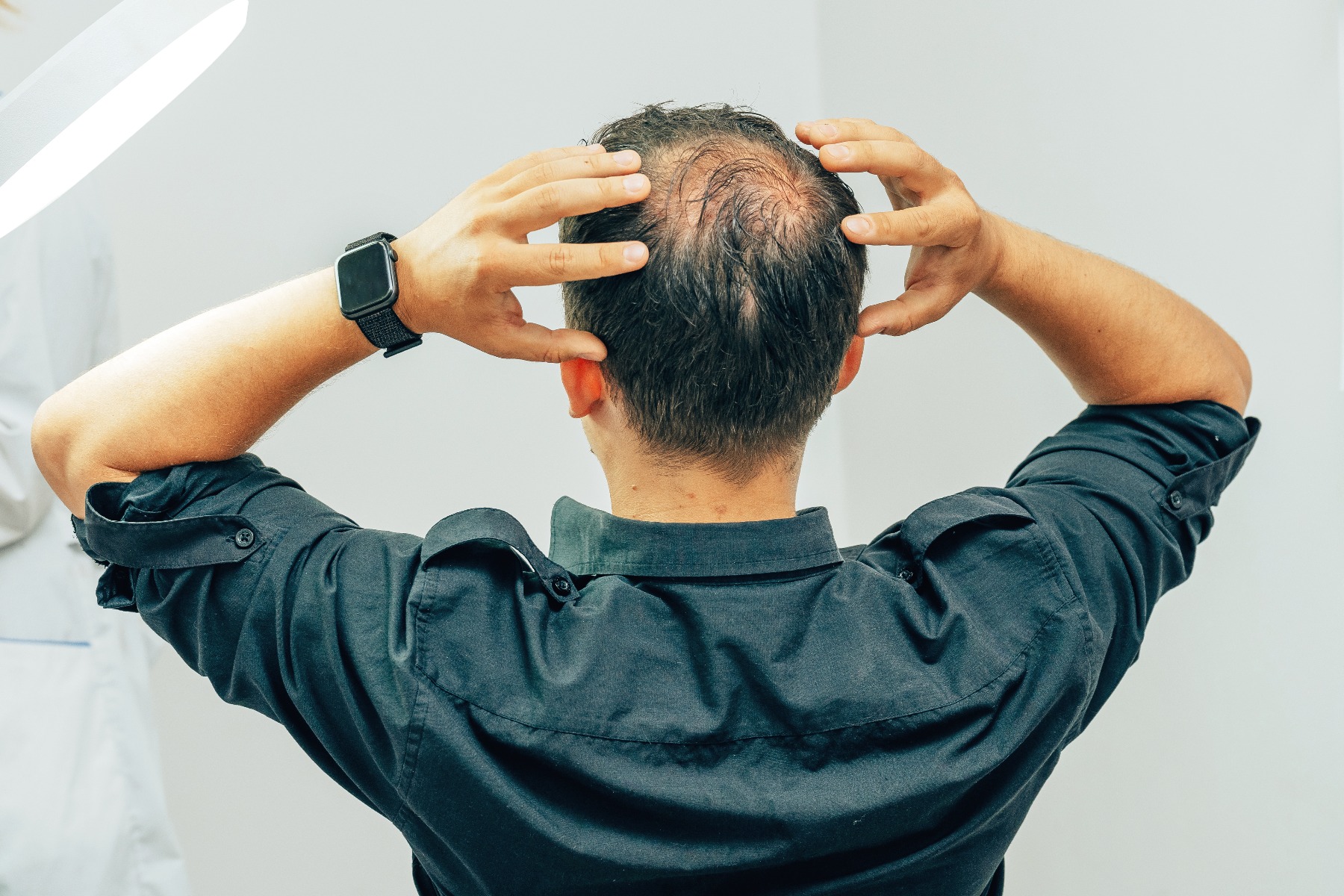 Does Finasteride Work To Treat Hair Loss?