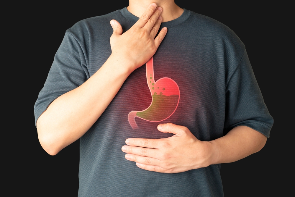 How Can I Treat Heartburn?