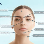 BOTOX Infographic Where When and Why