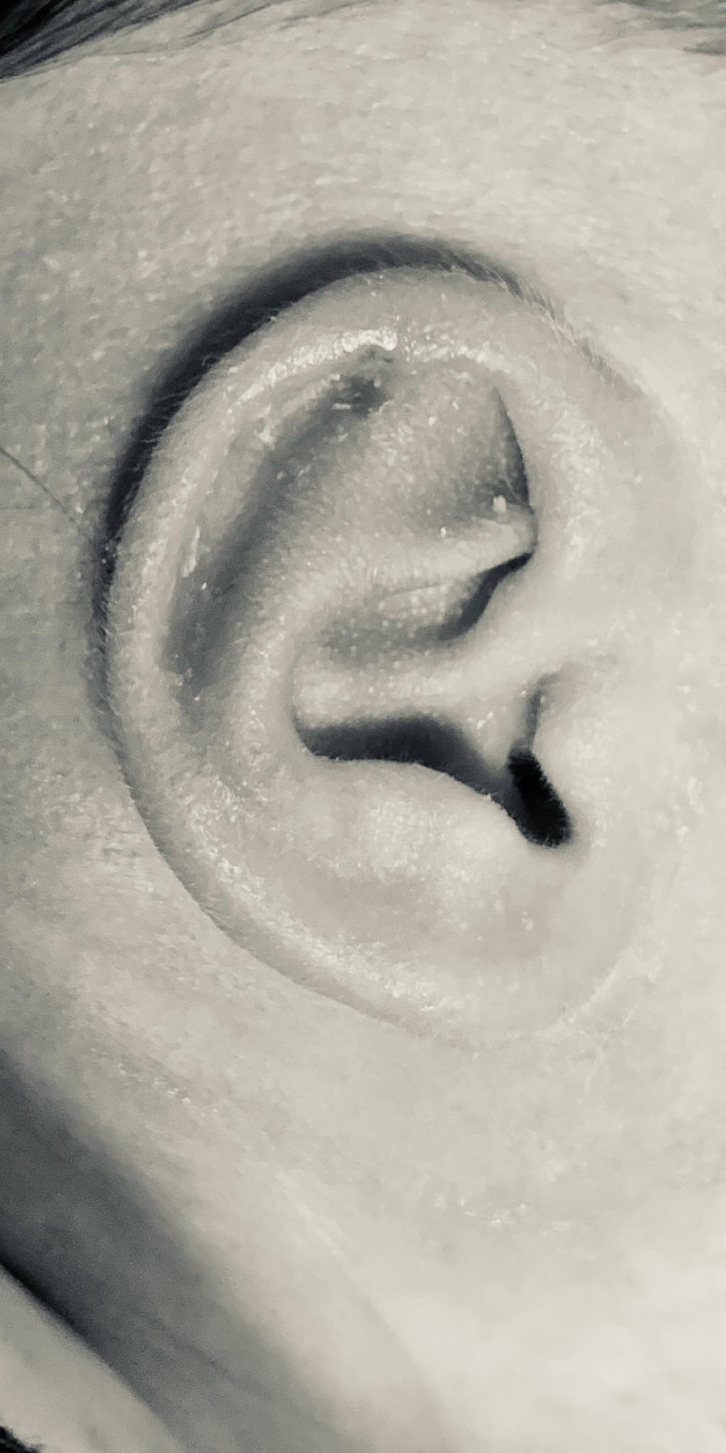 Pediatric Before & After Photos | Refine Facial Plastic Surgery and ...