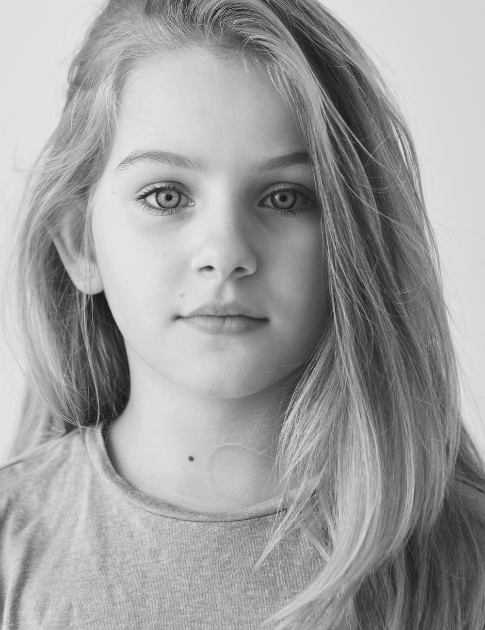 Pediatric Care | Refine Facial Plastic Surgery and Aesthetics