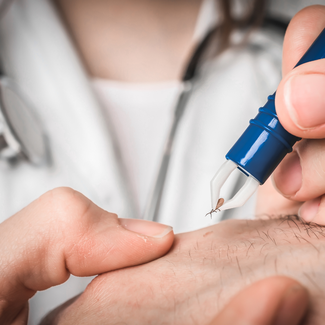 Tekenbeet Herkennen En Behandelen Doktr
