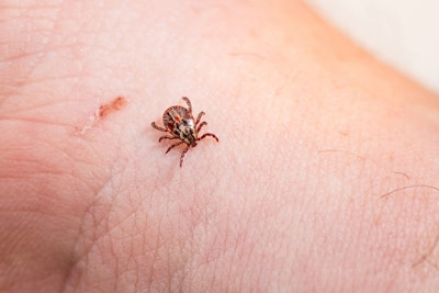 Reconnaître et traiter les piqûres de tiques - Doktr