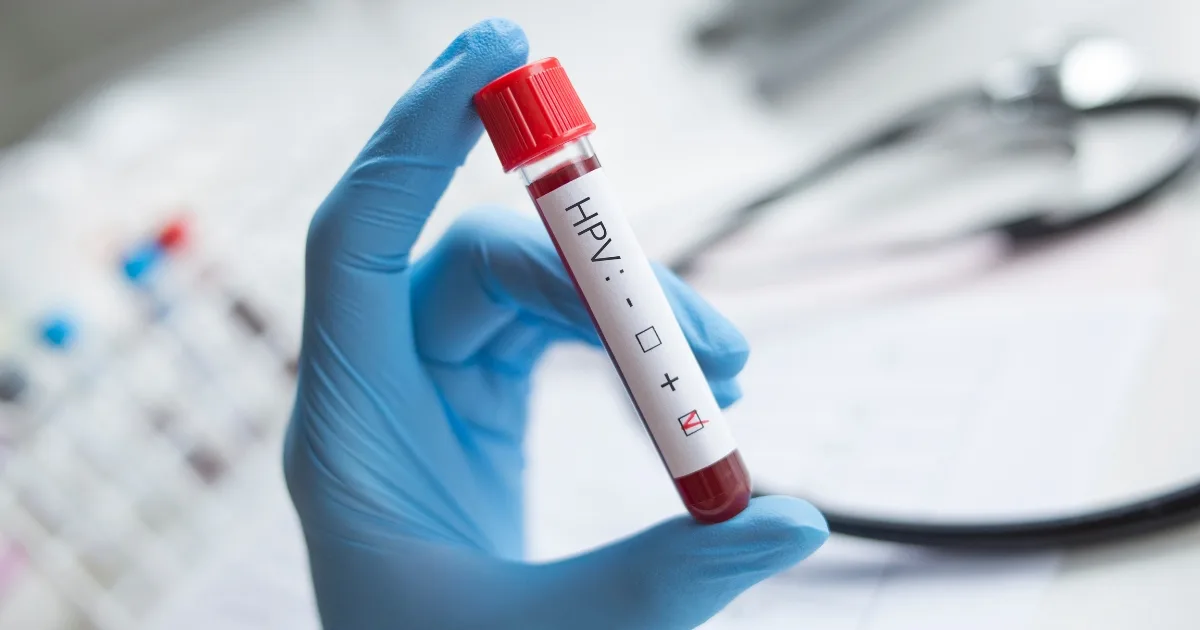 Humaan papillomavirus (HPV) - Doktr