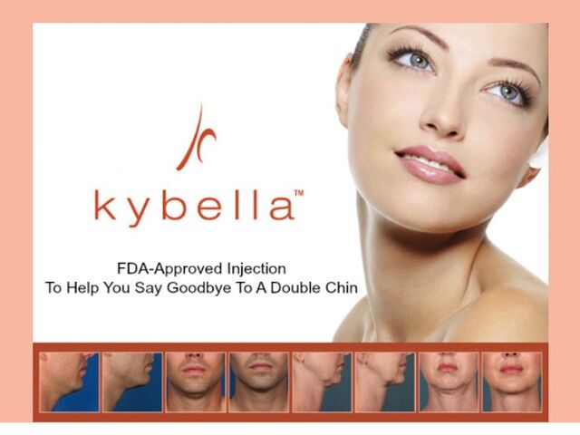 20% off KYBELLA® - Parakh Plastic Surgery
