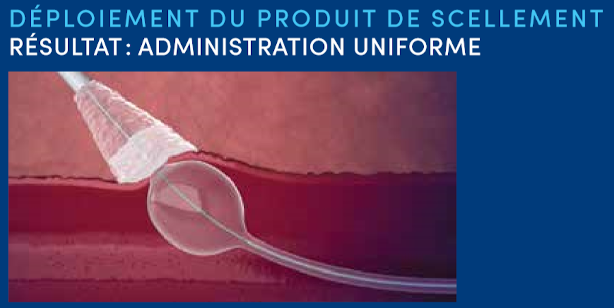 Guide utilisation de Mynx