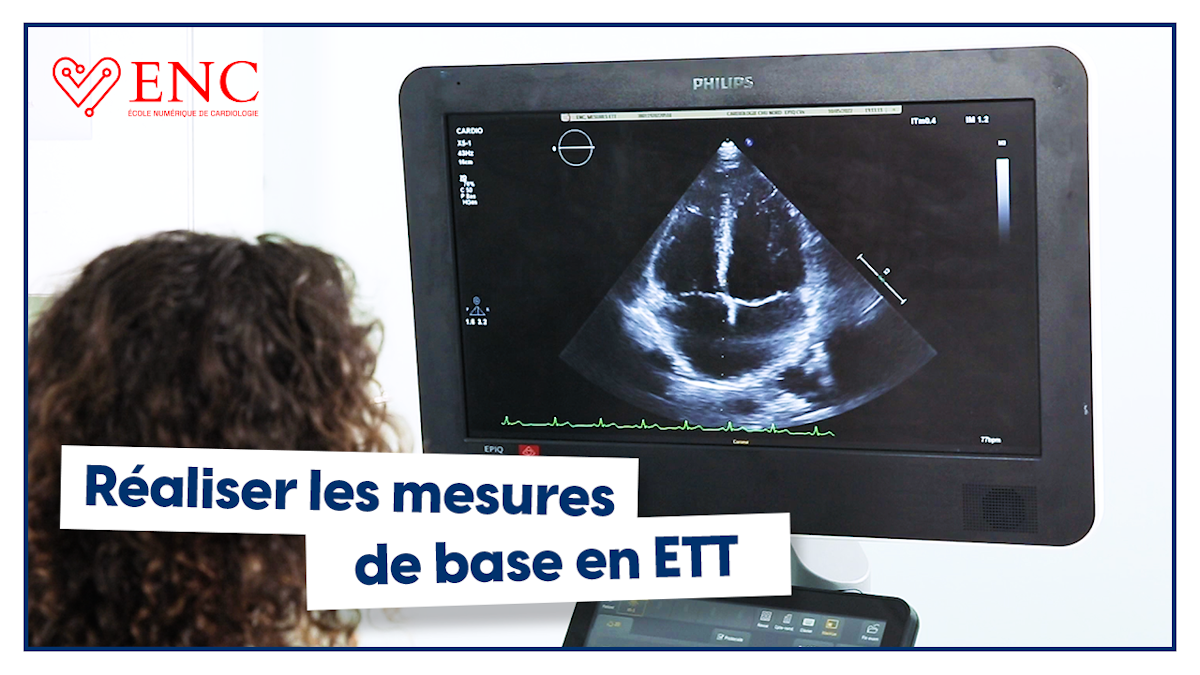 Comment réaliser les mesures de bases en ETT