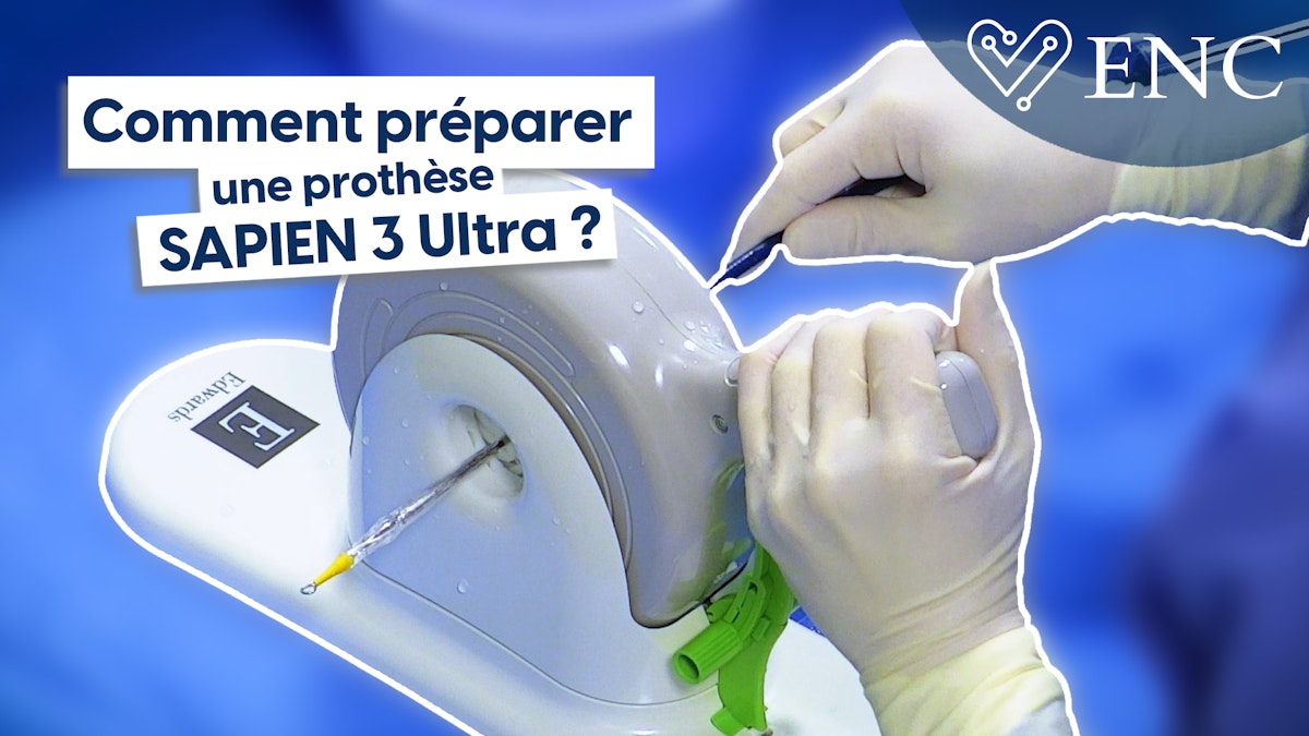 Comment sertir une prothèse TAVI Sapien 3 Ultra