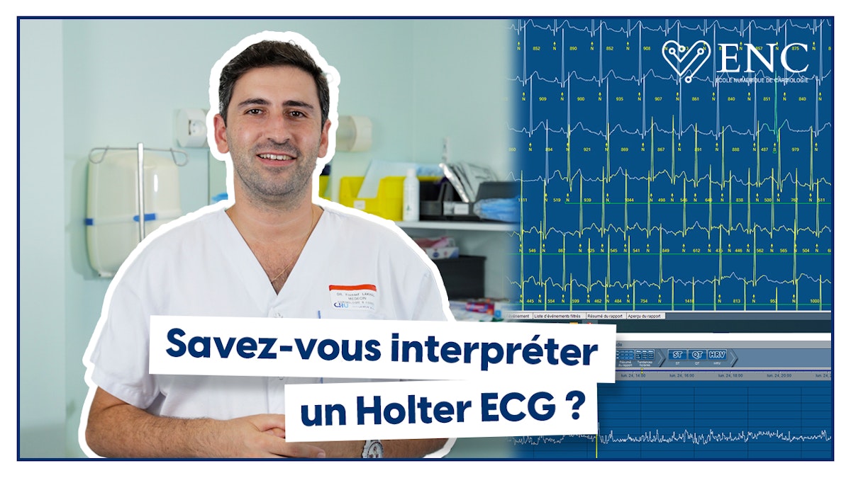 Comment interpréter un Holter ECG