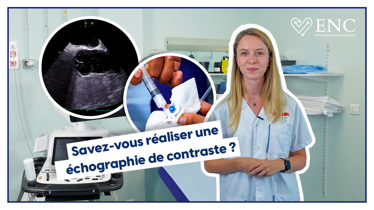 Comment réaliser une écho de contraste (bulle, SonoVue®)