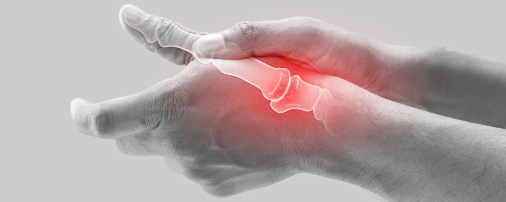 A Guide to Medicare Coverage for Arthritis: Diagnosis and Treatment ...