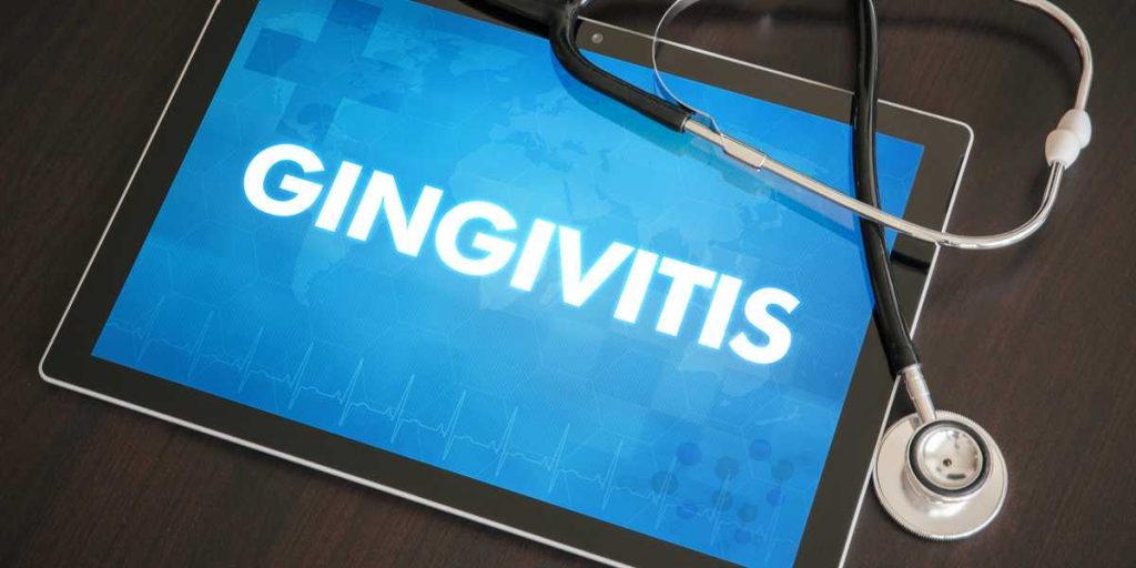 How to prevent, detect and treat gingivitis - Obesity Control Center