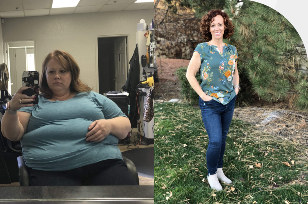 Patients Feel Safe At OCC As COVID-19 Makes Bariatric Surgery More ...
