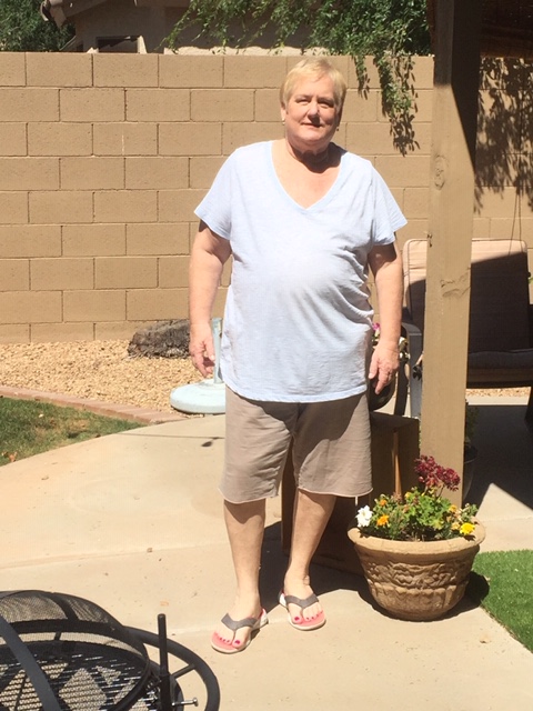 Patients 60-88 Years Old Before & After Photos | Obesity Control Center
