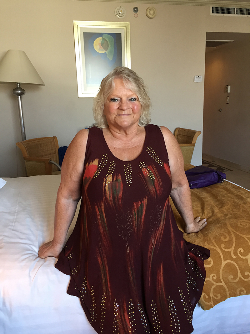 Patients 60-88 Years Old Before & After Photos | Obesity Control Center