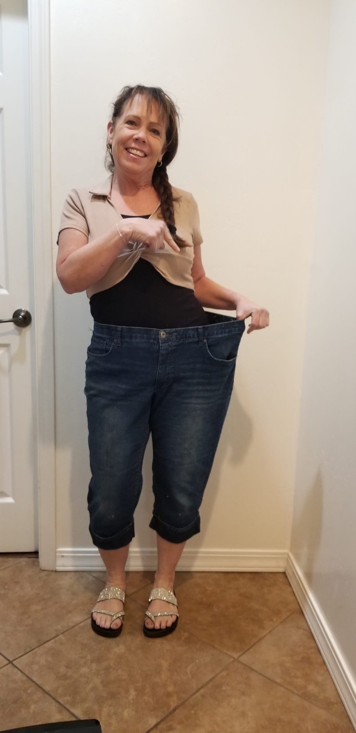 Patients 40-59 Years Old Before & After Photos | Obesity Control Center