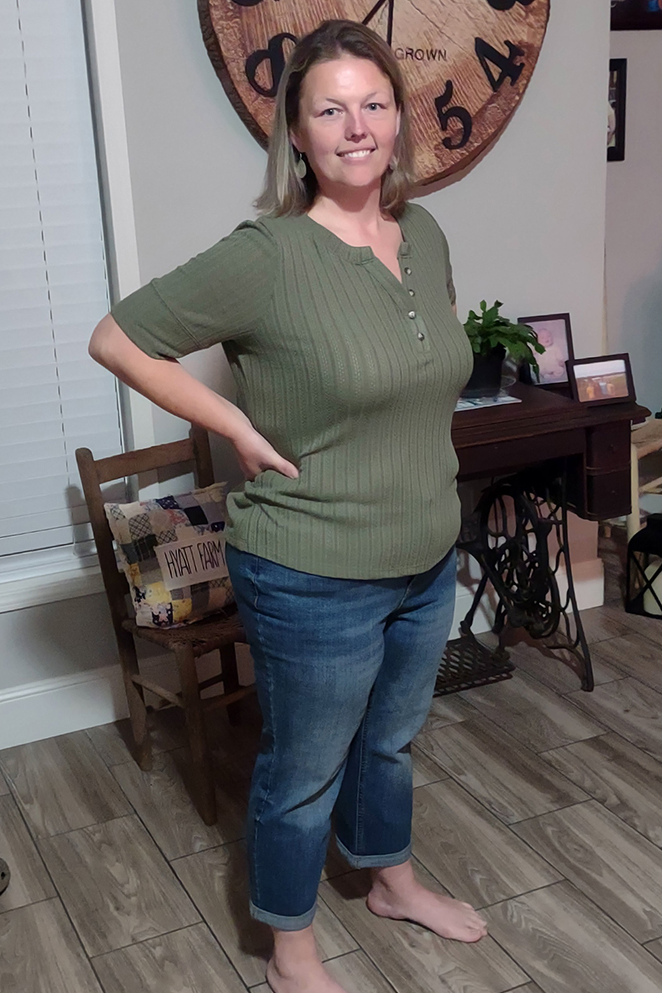 Patients 20-39 Years Old Before & After Photos | Obesity Control Center