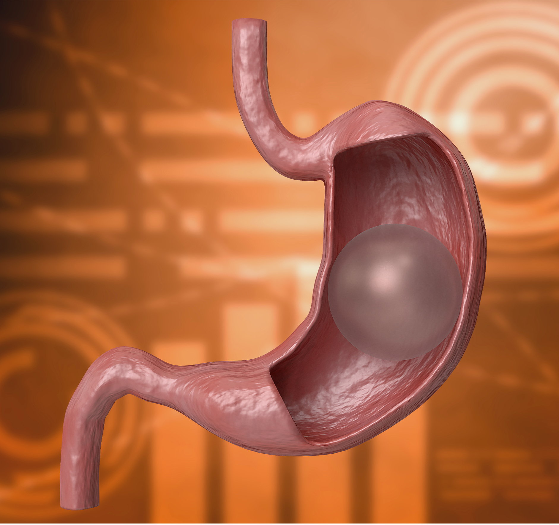 Orbera® Tulsa - Roller Weight Loss & Advanced Surgery