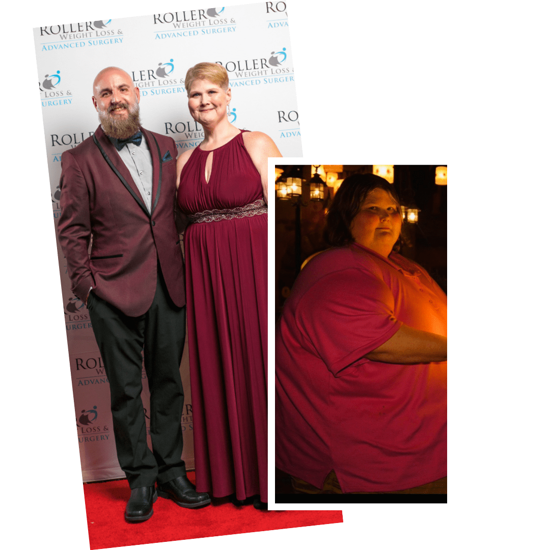 Patient Stories | Roller Weight Loss & Advanced Surgery