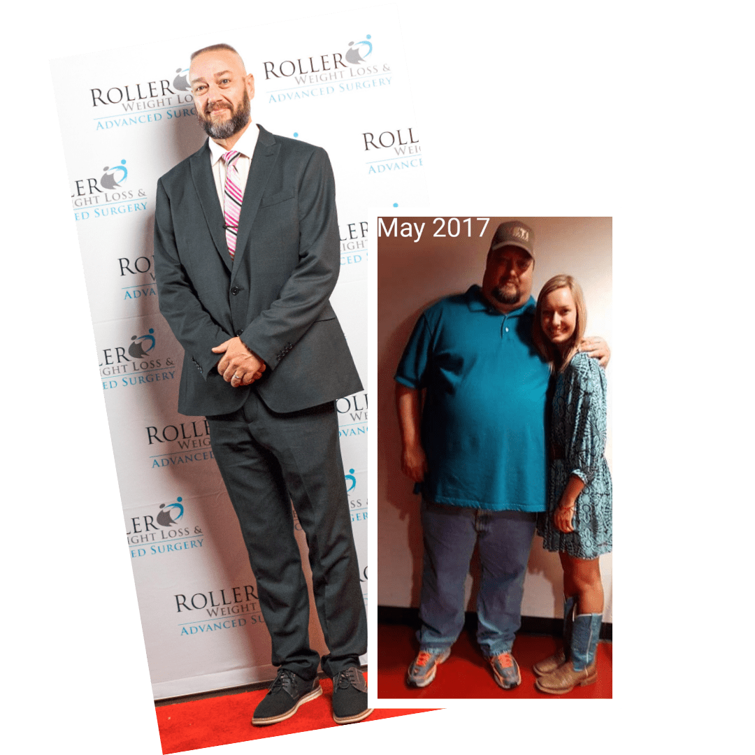 Patient Stories | Roller Weight Loss & Advanced Surgery