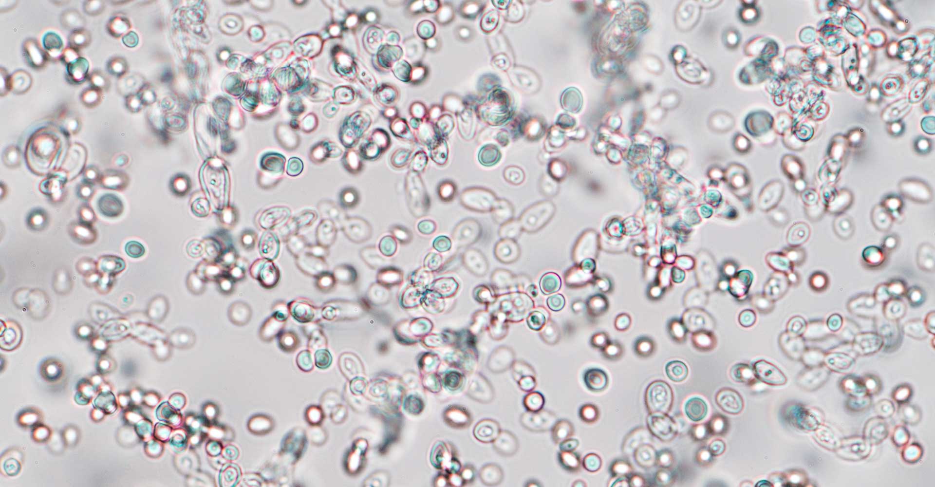 Under the Microscope: Dealing with Diastaticus in the Brewhouse | Brewing Industry Guide