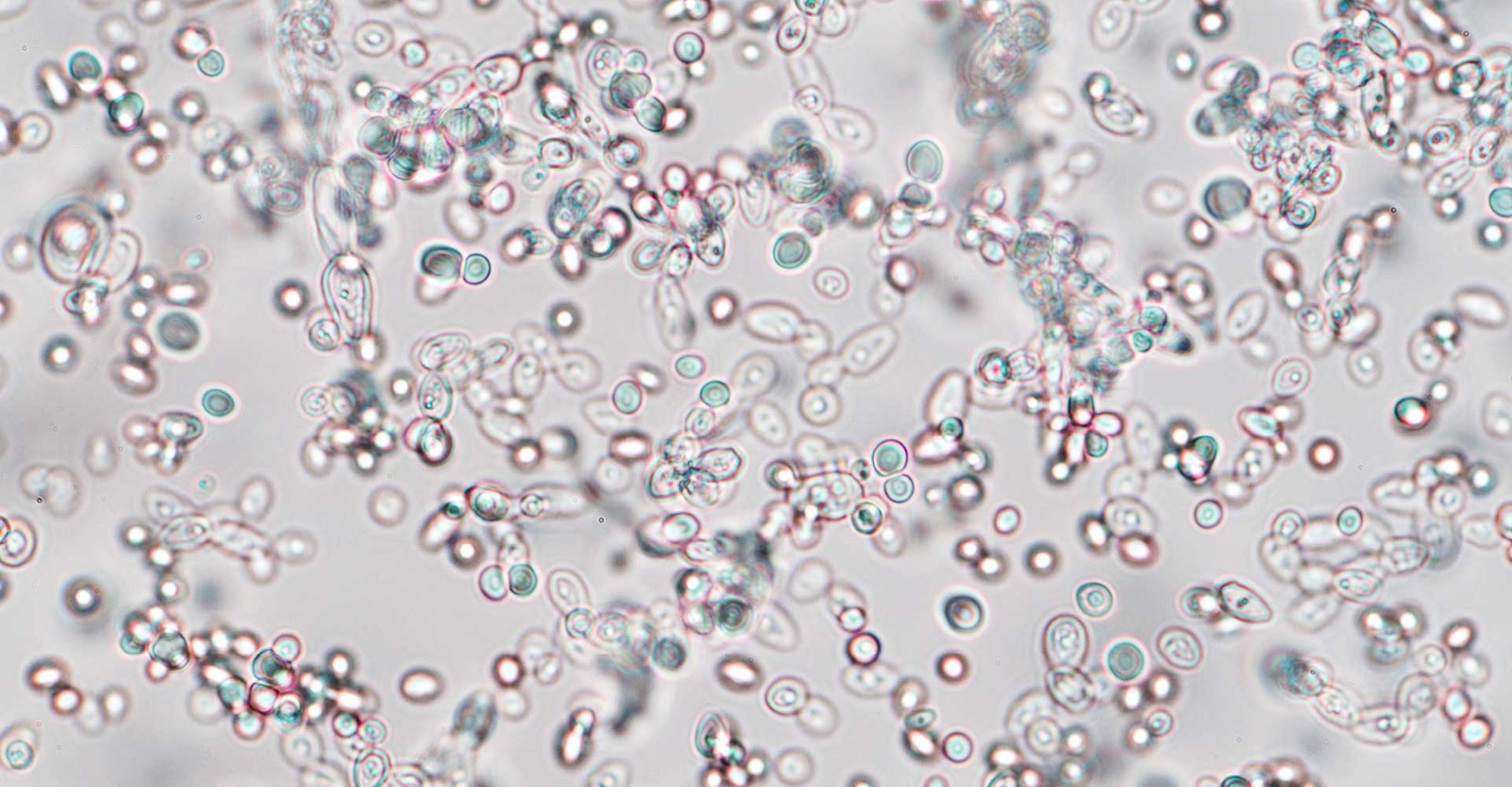 Budding Yeast Cells Under Microscope