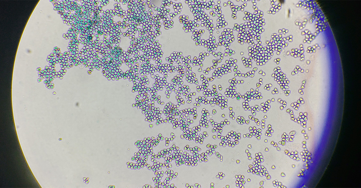 Under the Microscope: Six Tips to Improve Your Fermentations | Brewing ...