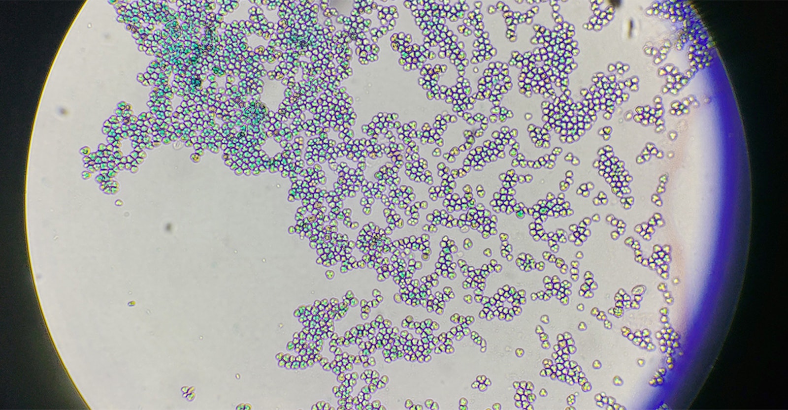 Under the Microscope: Six Tips to Improve Your Fermentations | Brewing Industry Guide
