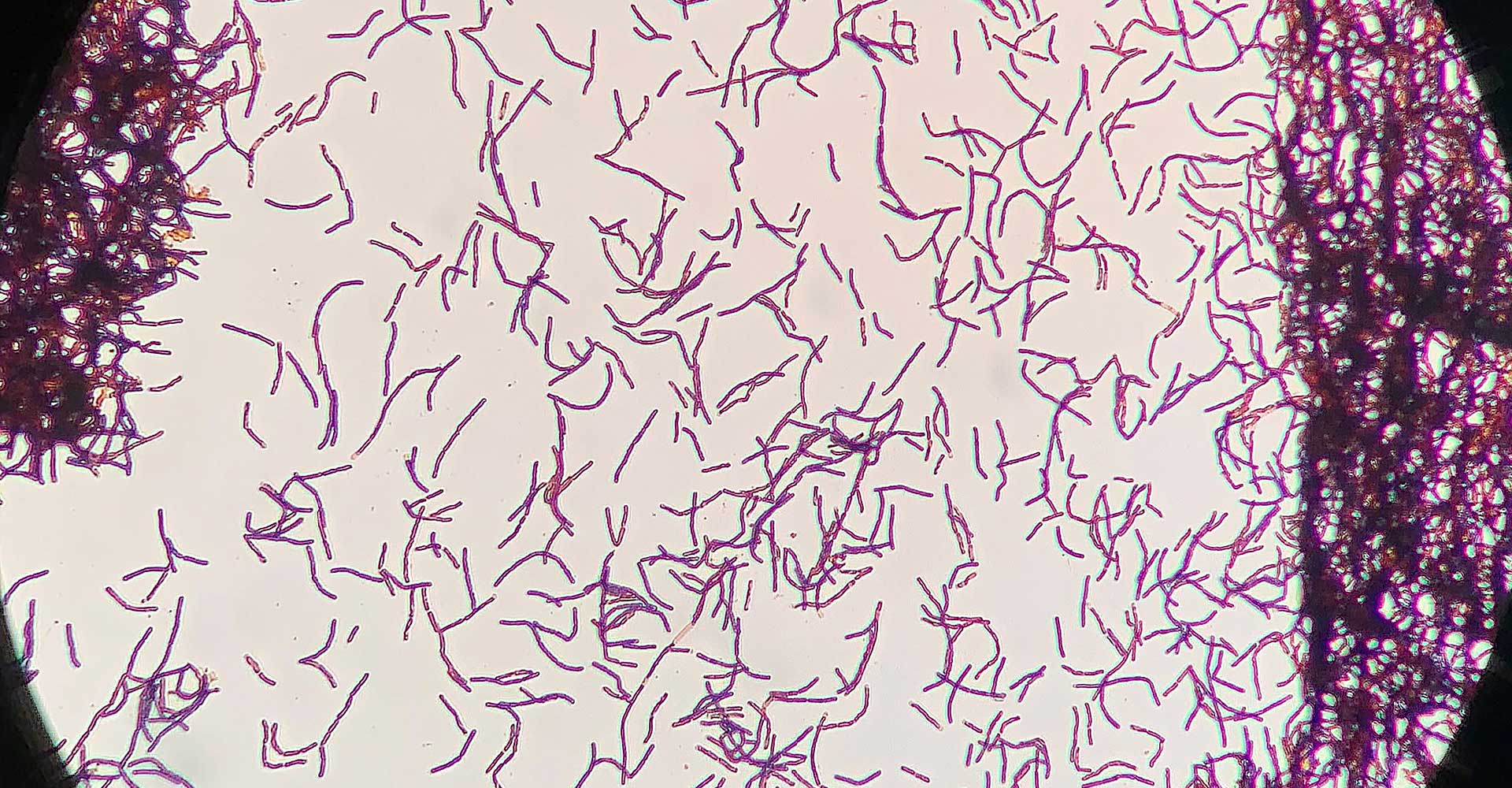 Bacillus Bacteria Under Microscope Microscopic Characteristics Of