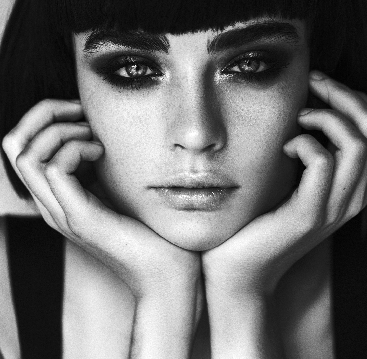 Topography-Guided PRK | Soroudi Advanced LASIK & Eye Centers