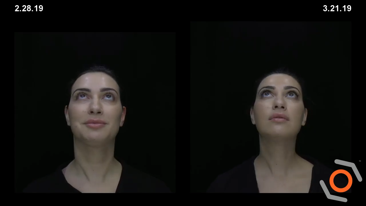 MyEllevate | Virginia Institute of Plastic Surgery