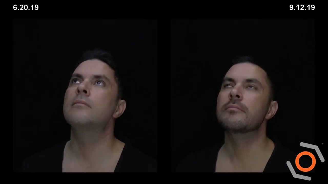 MyEllevate | Virginia Institute of Plastic Surgery