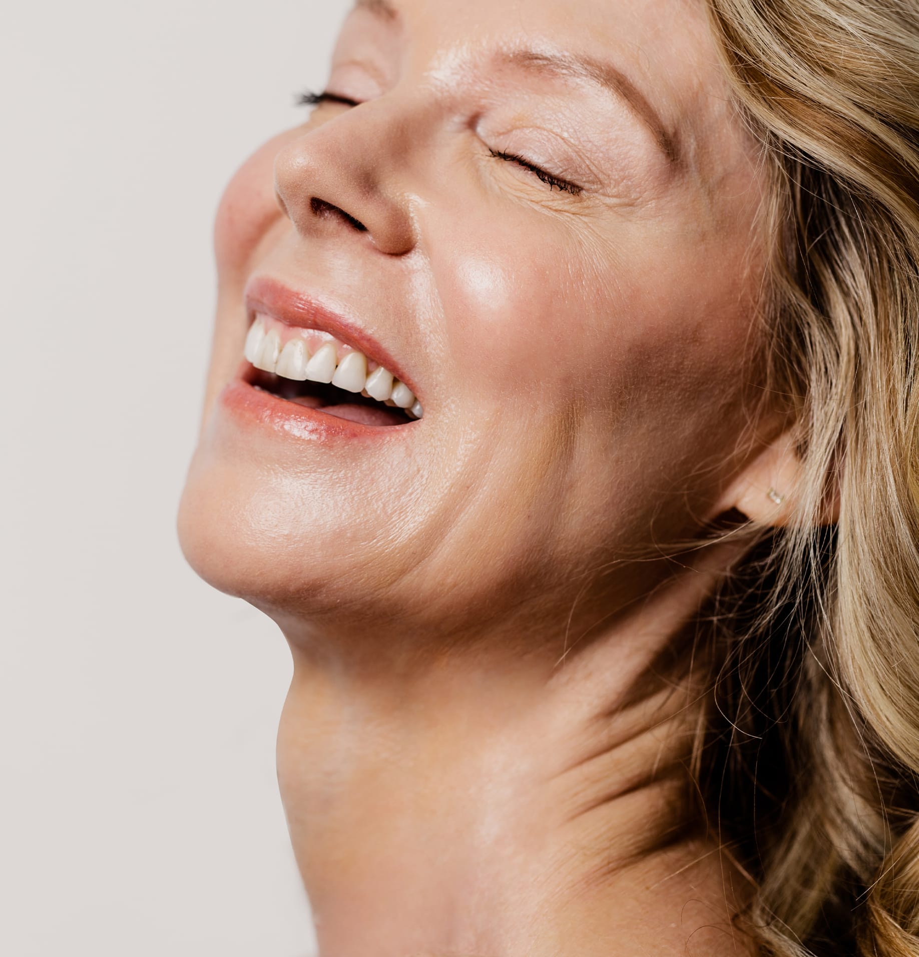 Mini Facelift in NYC | Neck Lift NYC | Bass Plastic Surgery