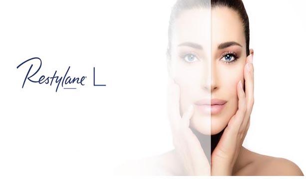 Restylane-L - CosmetiCare