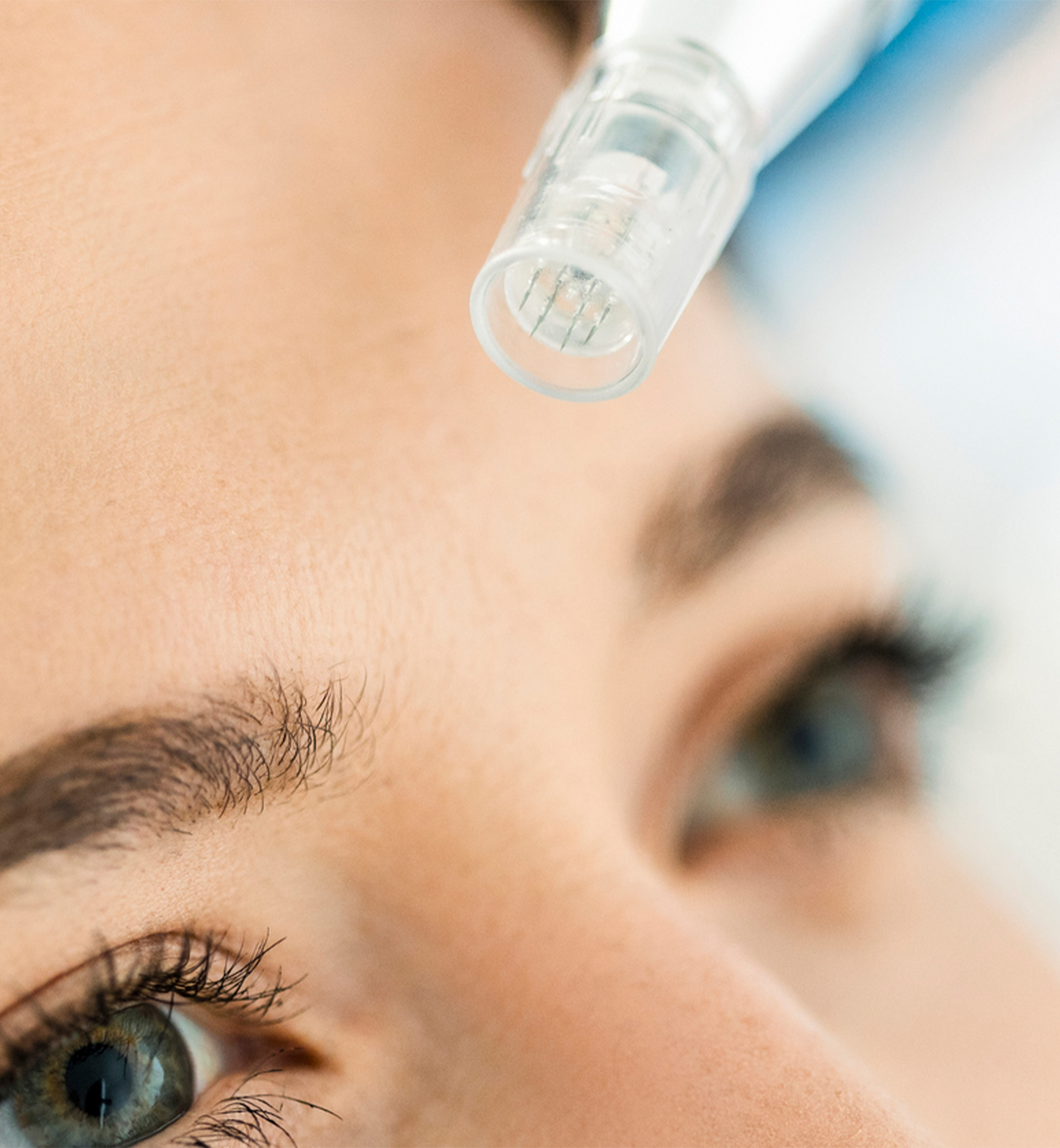 Microneedling Fredericksburg | The Dermatology Center