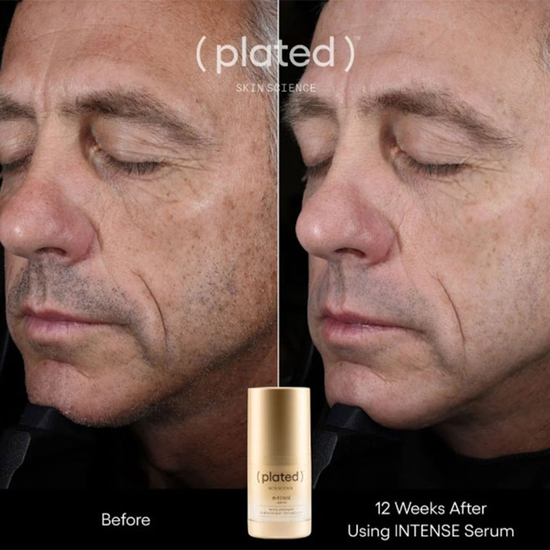 Unlock Radiant Skin with Plated Intense Serum | Flawless Med Spa